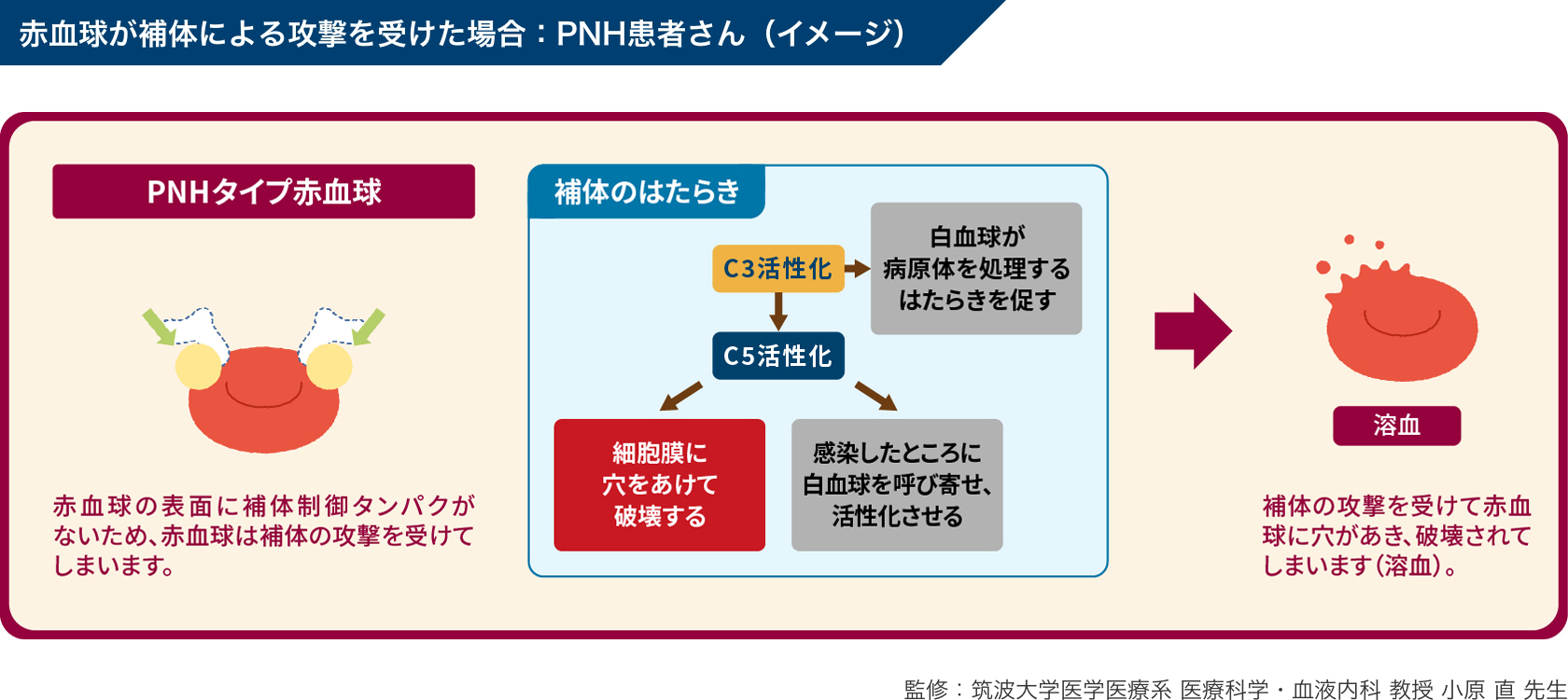 ピアスカイってどんな薬？ | ピアスカイ 発作性夜間ヘモグロビン尿症（PNH）TOP | 患者さん向け医薬品・医療機器情報 | 患者さん・一般 ...